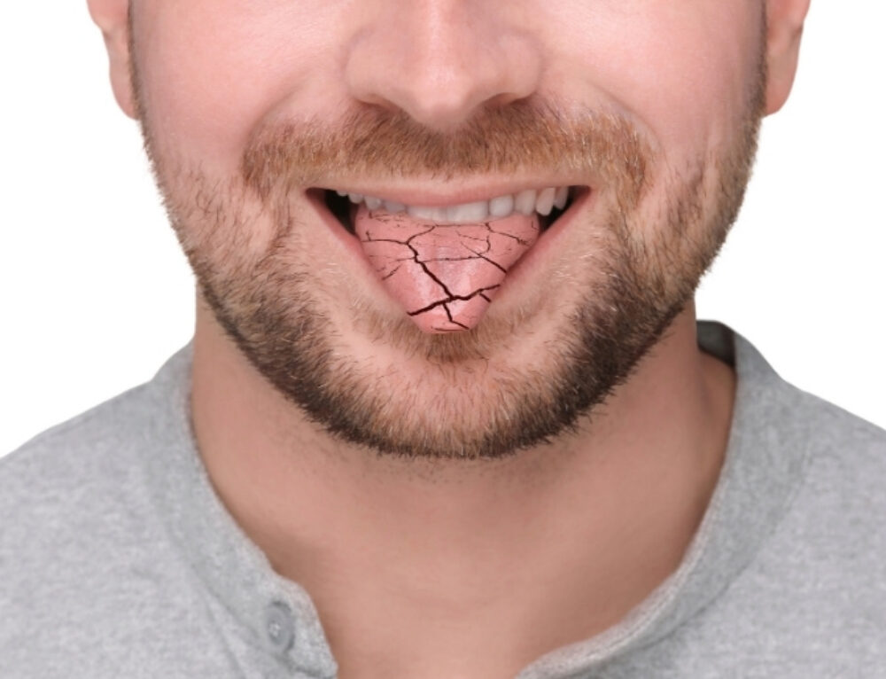 What Happens if You Lose an Adult Tooth? Here’s What You Can Do Next ...